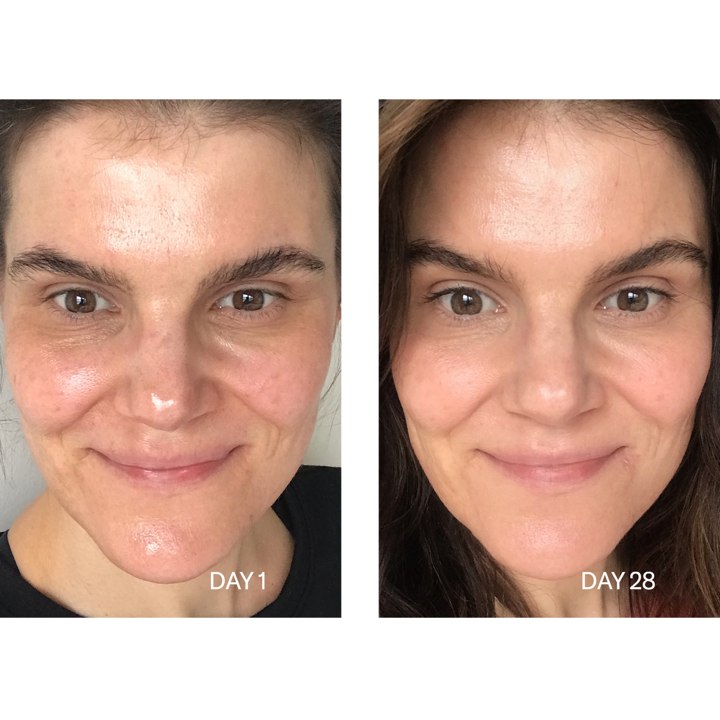 Summer Skin Bundles – Odacité